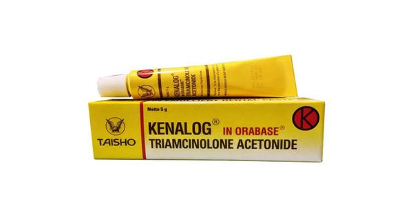 Kenalog in Orabase: Obat yang Efektif untuk Sariawan - InfoKerenMu